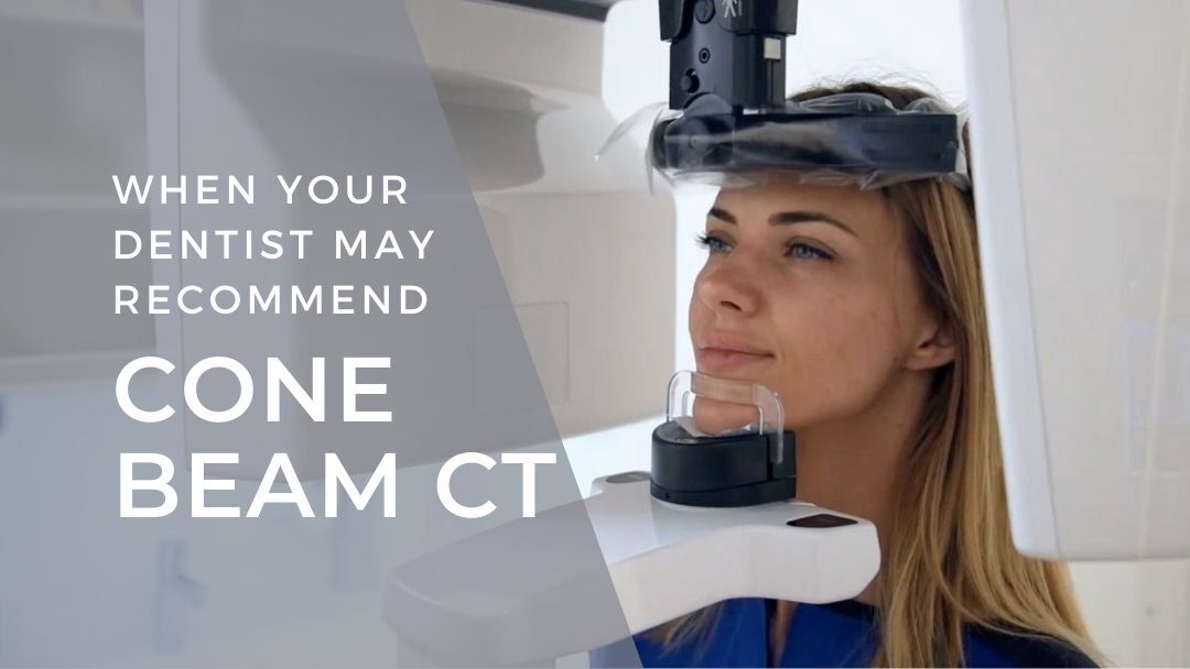 When Your Dentist May Recommend Dental Cone Beam CT | Reveal Diagnostics