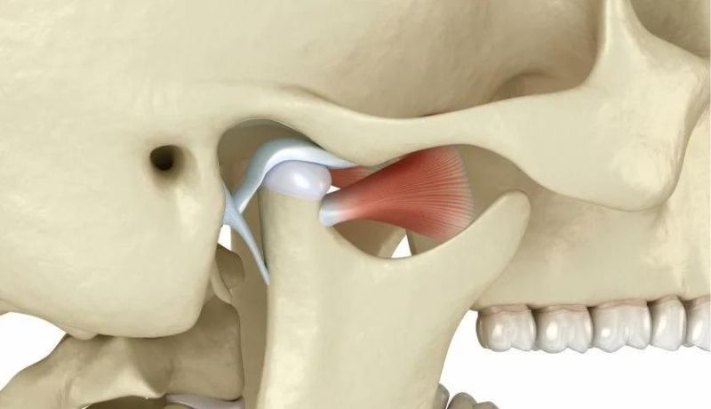 Temporomandibular Joint (TMJ) Imaging using Cone Beam CT