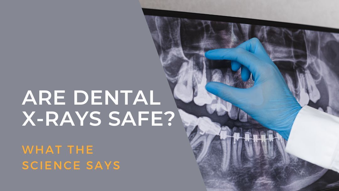 Are Dental X-Rays Safe? Here’s What the Science Says | Reveal Diagnostics