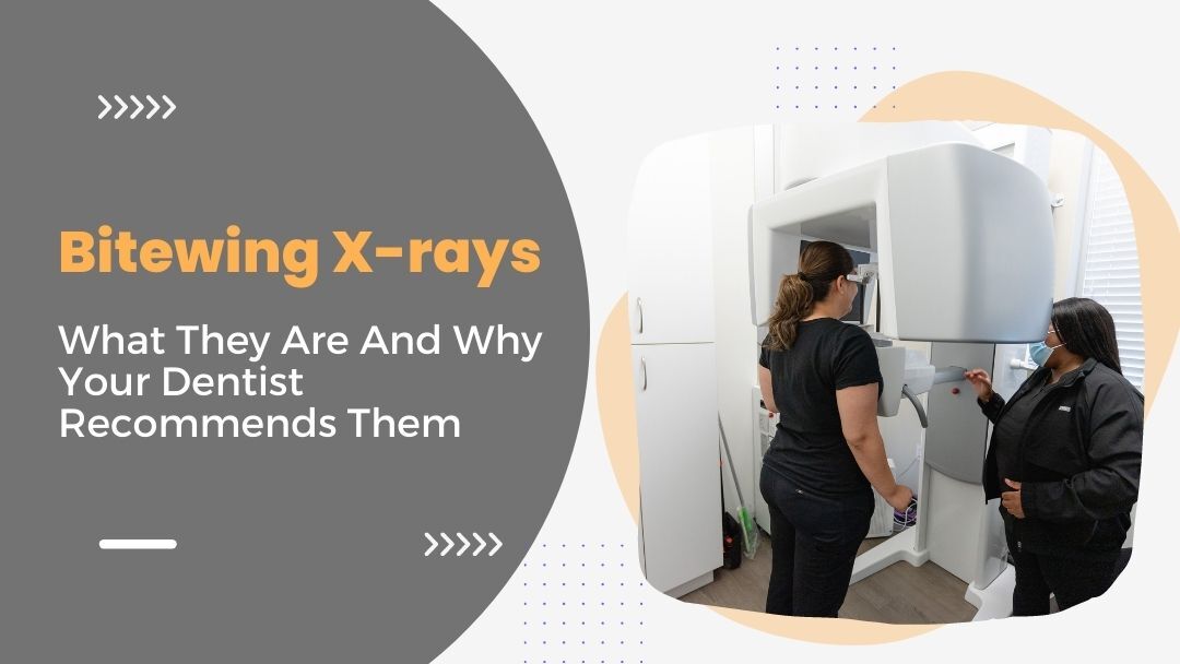 Bitewing X-rays: What They Are And Why Your Dentist Recommends Them ...