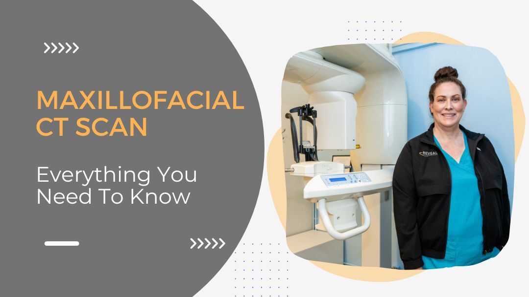Everything You Need To Know About Maxillofacial CT Scans