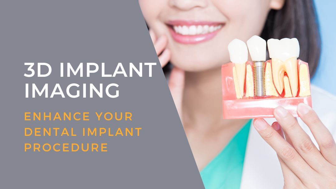 How 3D Dental Implant Imaging Enhances Your Dental Implant Procedure